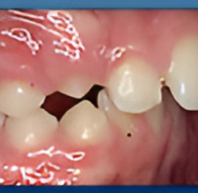 Common Problems | Wesley E. King, D.D.S., P.A. | King Orthod